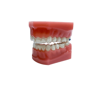 MANEQUIM INVISALIGN CLASS II - Invisalign